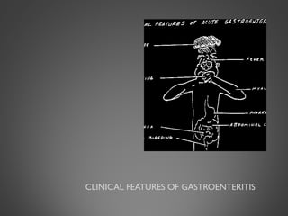 Gastroenteritis | PPT