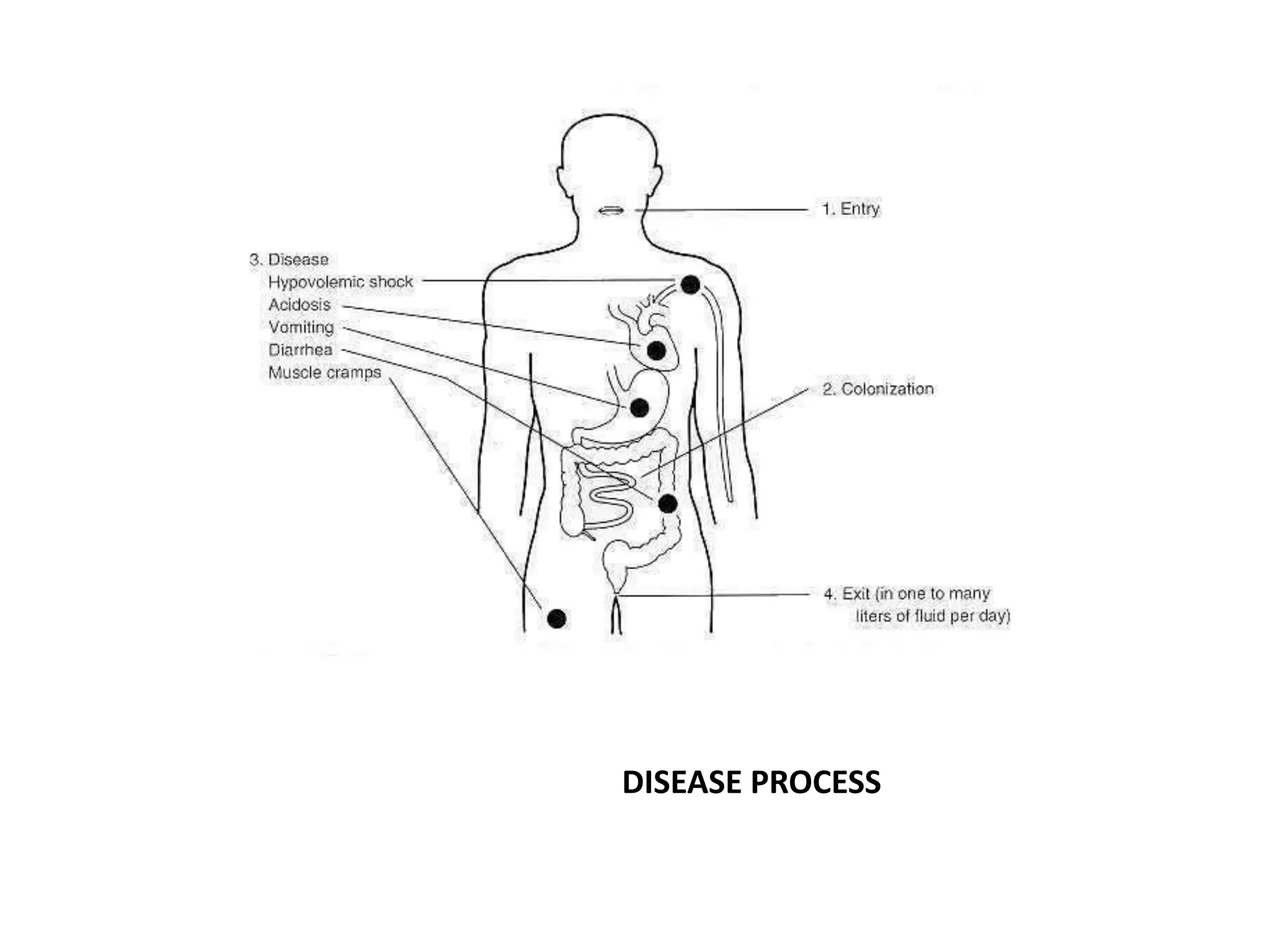 Gastroenteritis | PPTX | Digestive Disorders | Diseases and Conditions