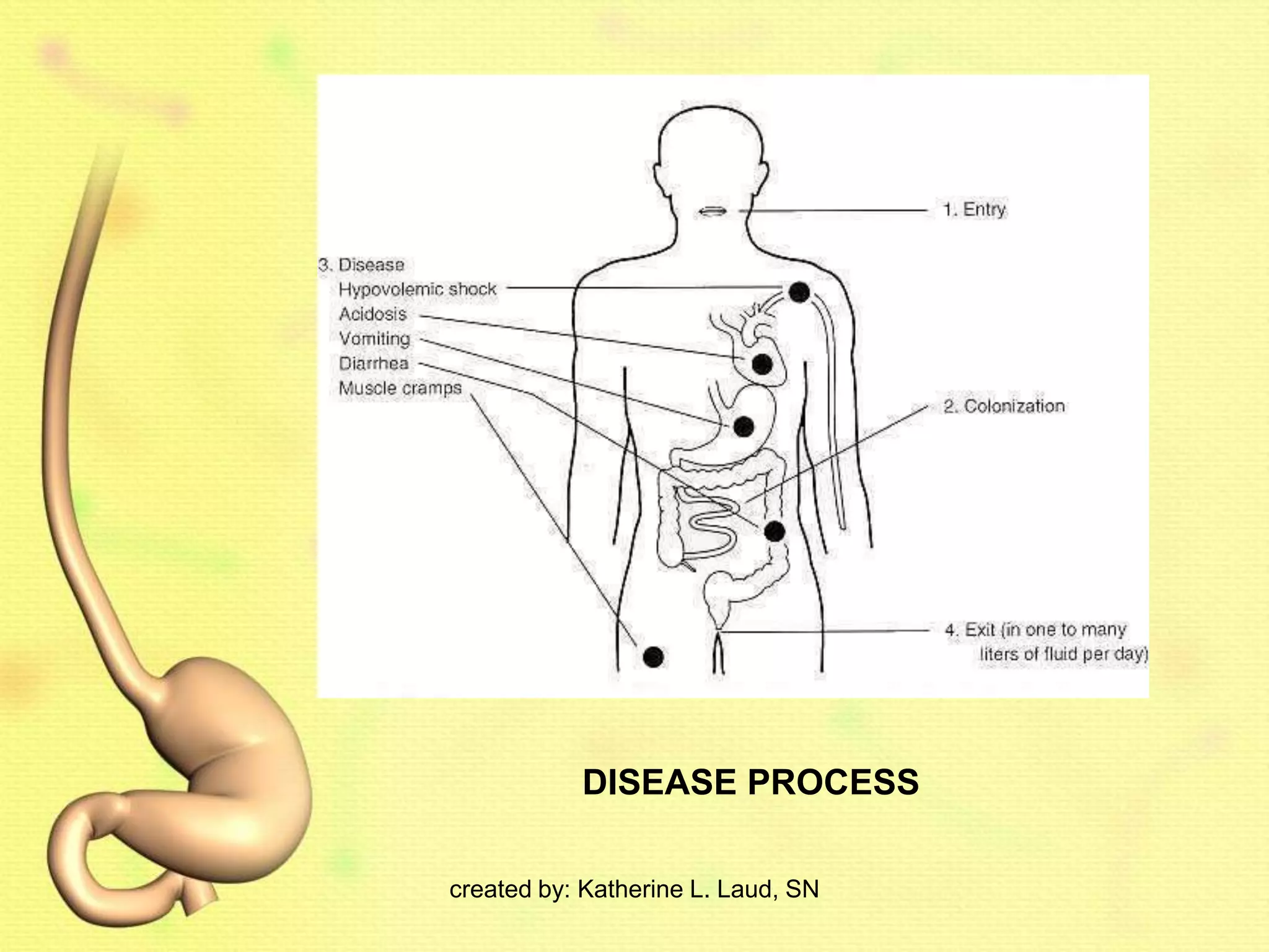 Gastroenteritis ppt | PPTX