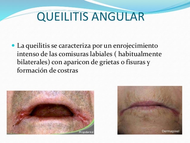 Gastroenterologia primer tema