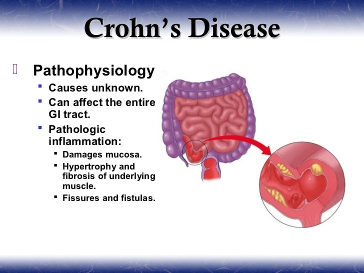 Gastroenterology