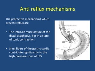 Gastro esophageal reflux disease | PPT