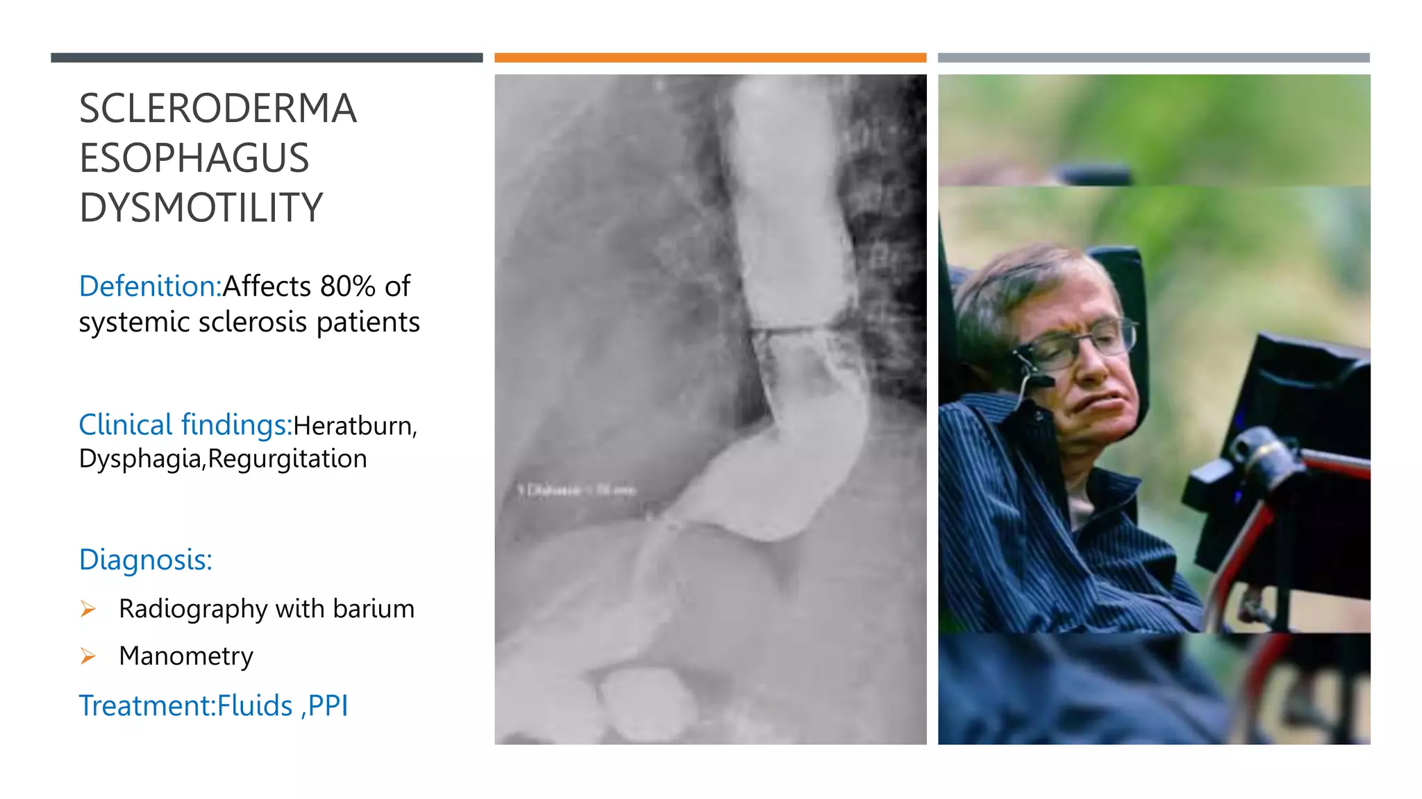gi system | PPTX