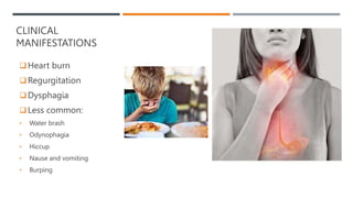gi system | PPTX