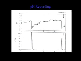 GASTROESOPHAGEAL REFLUX DISEASE.pdf
