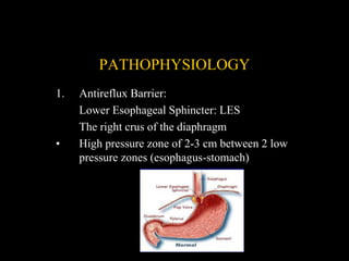 GASTROESOPHAGEAL REFLUX DISEASE.pdf