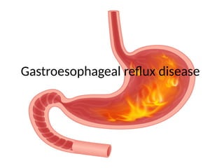 Gastroesophageal reflux disease and itsnursingmanagement .pptx