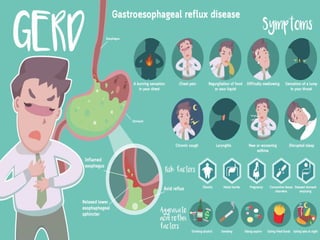 Gastroesophageal reflux disease AND NURSING MANAGEMENT | PPTX
