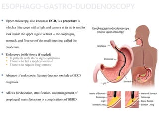 Gastroesophageal reflux disease AND NURSING MANAGEMENT | PPTX