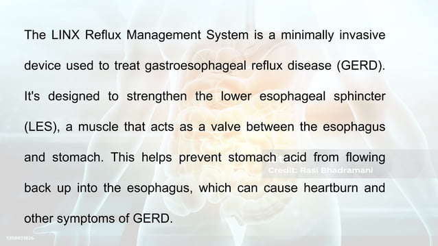 GASTROESOPHAGEAL REFLUX DISEASE.pptx for bsc nursing | PPT