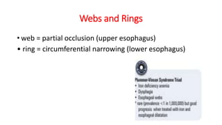 Gastroesophageal Reflux Disease (1).pptx