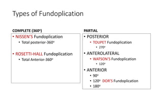 GASTROESOPHAGEAL REFLUX DISEASE copy.pptx