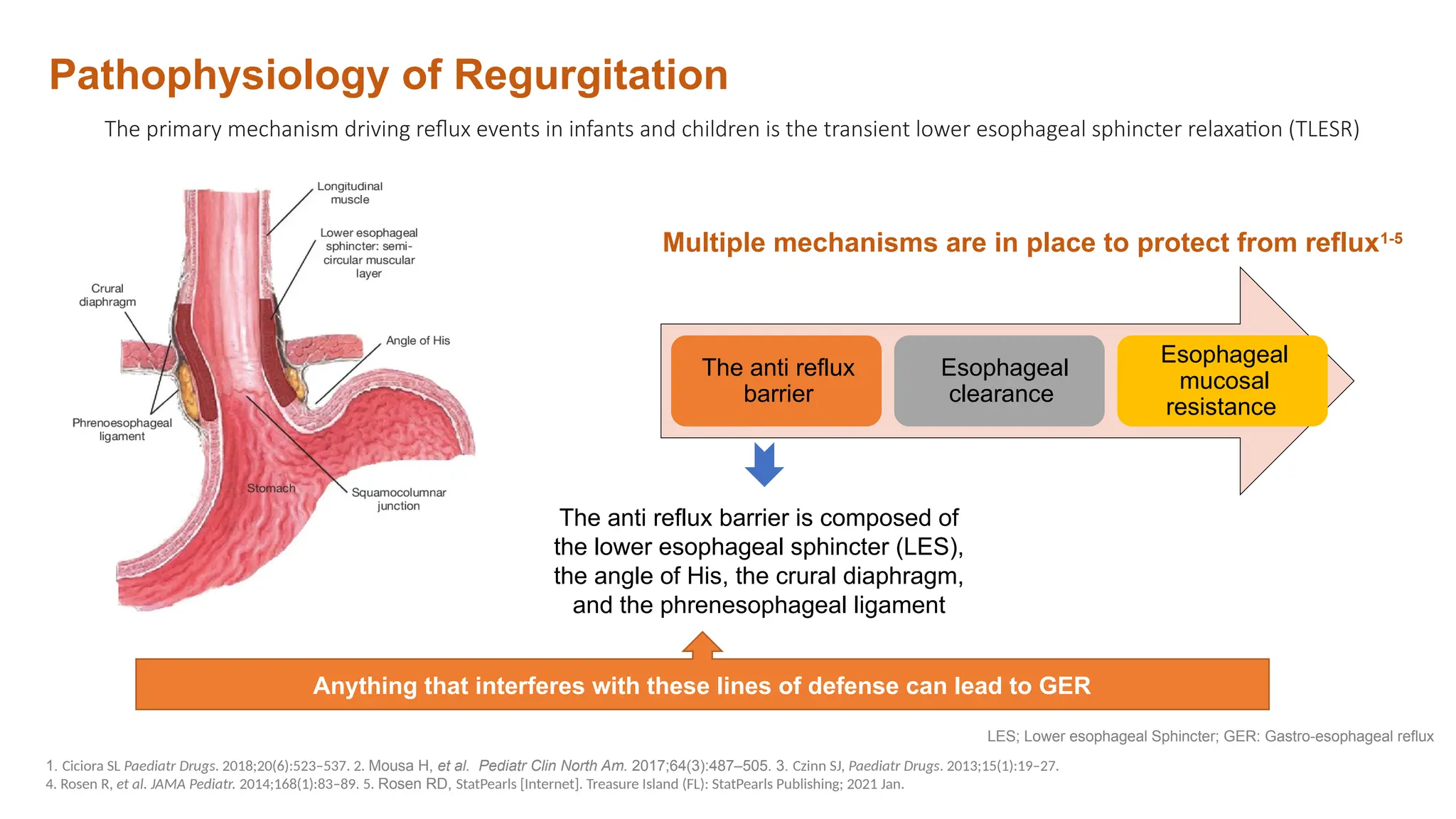 Gastroesophageal Reflux in Infants (GERD) | PPTX