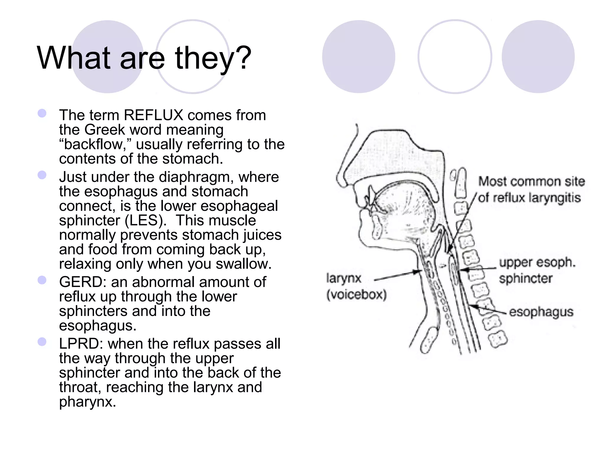 Gastroespohageal reflux disease (gerd) amp.ppt;amp.ppt ...