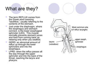 Gastroespohageal reflux disease (gerd) amp.ppt;amp.ppt ...