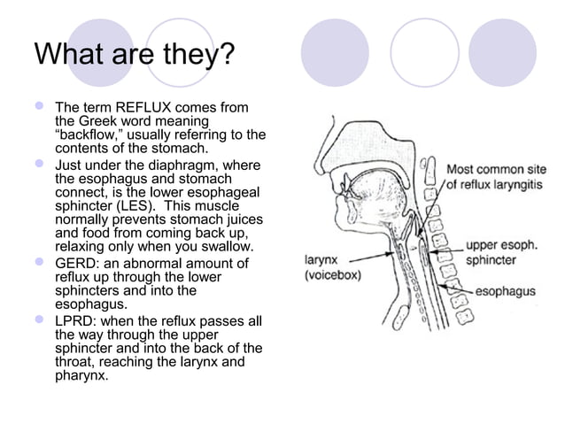 Gastroespohageal reflux disease (gerd) amp.ppt;amp.ppt ...