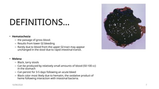 GASTROINTESTINA BLEEDING in paediatrics. | PPTX