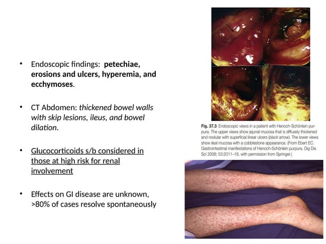 Gastrointestinal and Hepatic manifestations of Systemic Diseases-I.pptx
