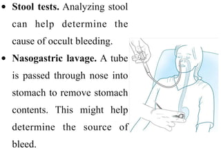 Gastrointestinal bleeding.pdf