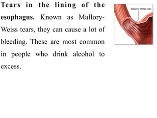 Gastrointestinal bleeding.pdf