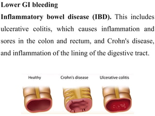 Gastrointestinal bleeding.pdf