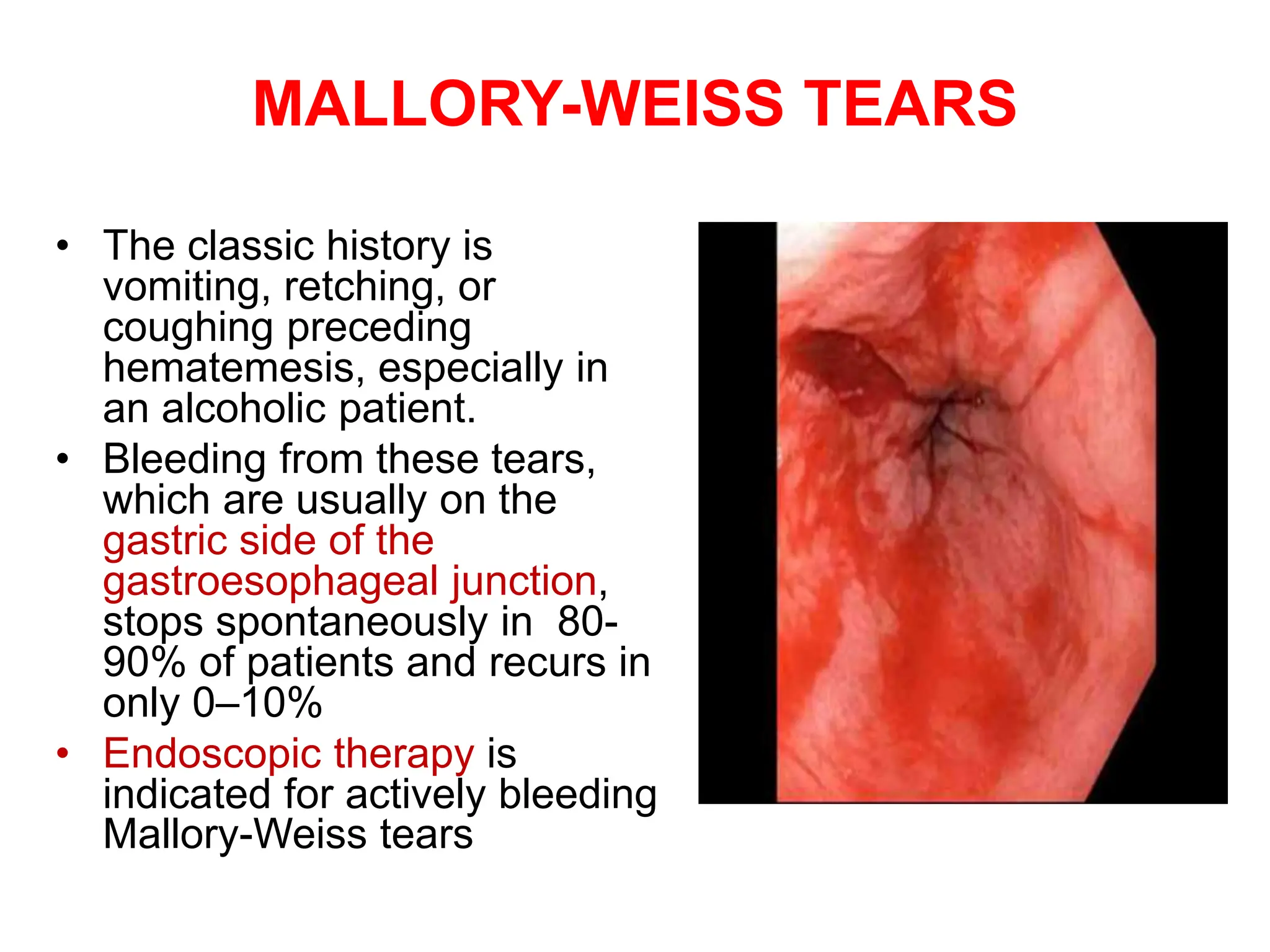 gastrointestinal bleeding.pptx