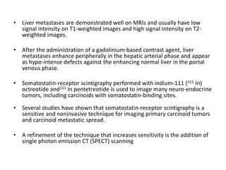 Gastrointestinal carcinoids | PPTX