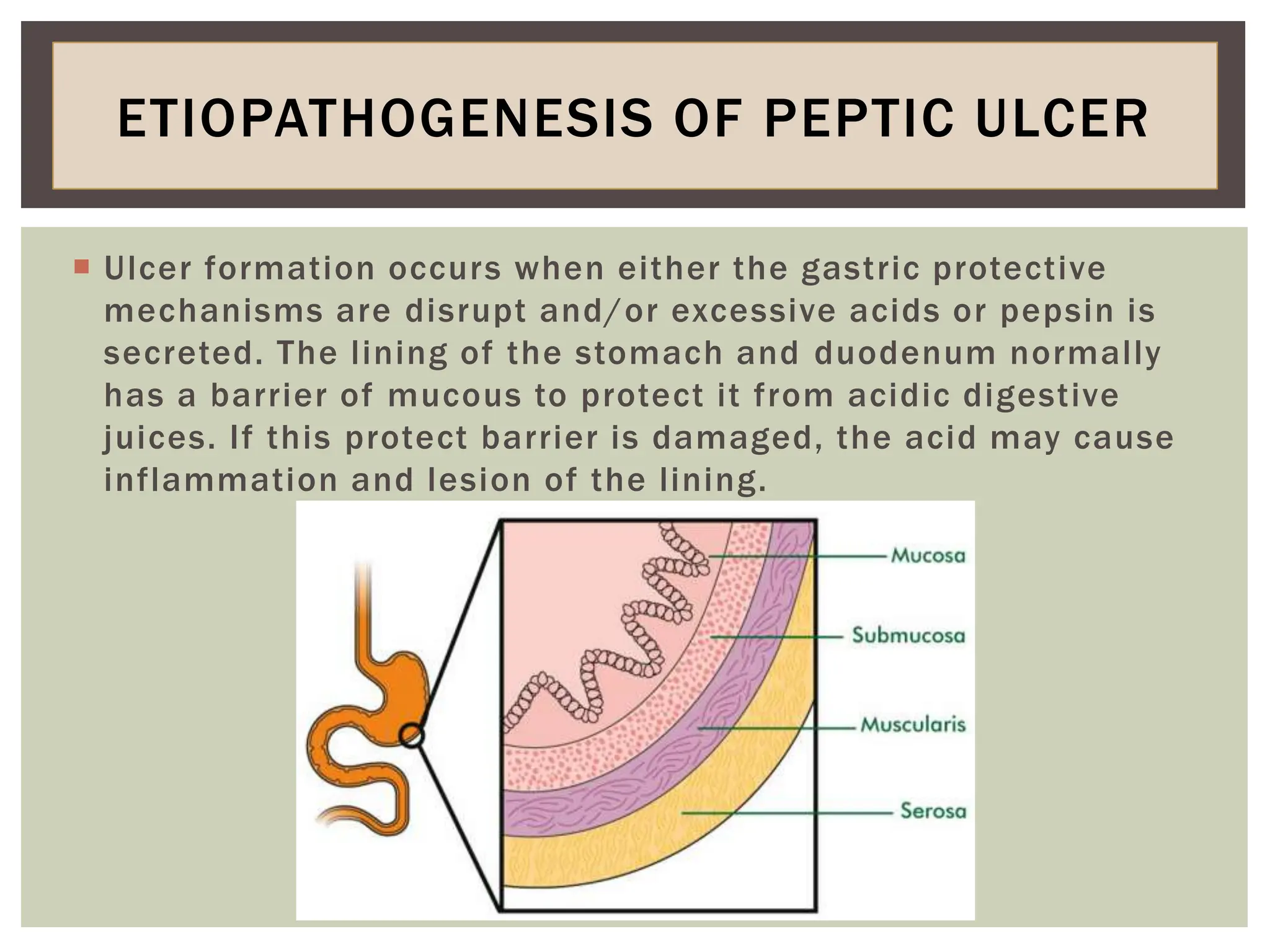 Gastrointestinal_Disorder.pptx, GERD, Peptic Ulcer Diseases ...