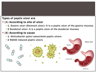 Gastrointestinal_Disorder.pptx, GERD, Peptic Ulcer Diseases ...