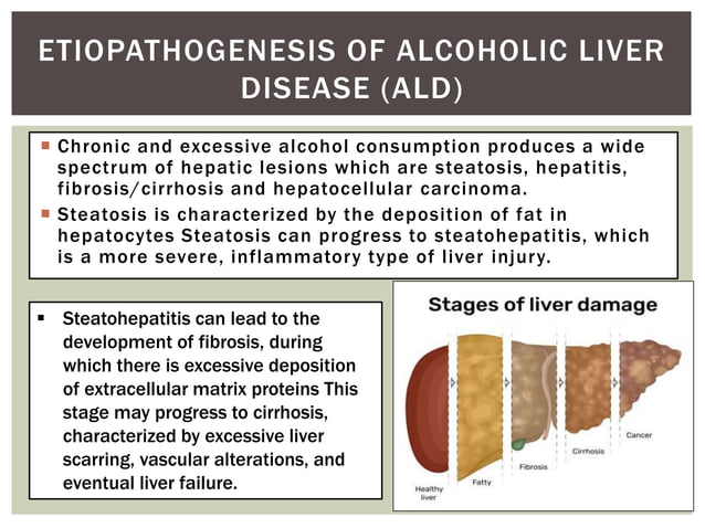 Gastrointestinal_Disorder.pptx, GERD, Peptic Ulcer Diseases ...