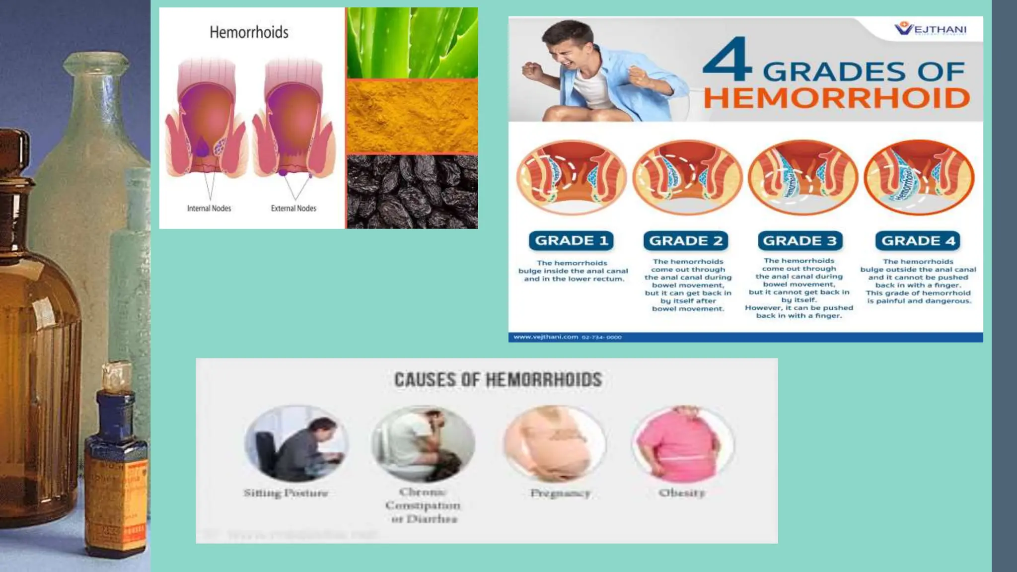 Gastrointestinal Disorders. Ischemic colitis, colon polyps, colorectal ...