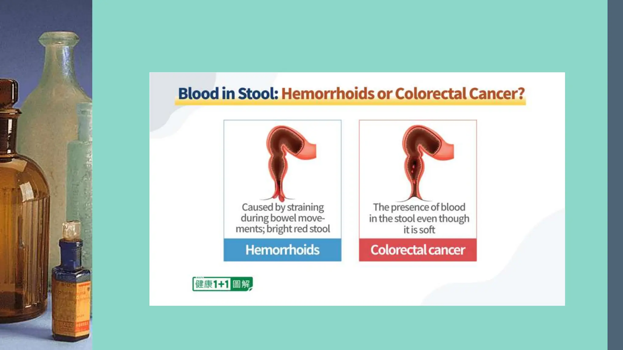 Gastrointestinal Disorders. Ischemic colitis, colon polyps, colorectal ...