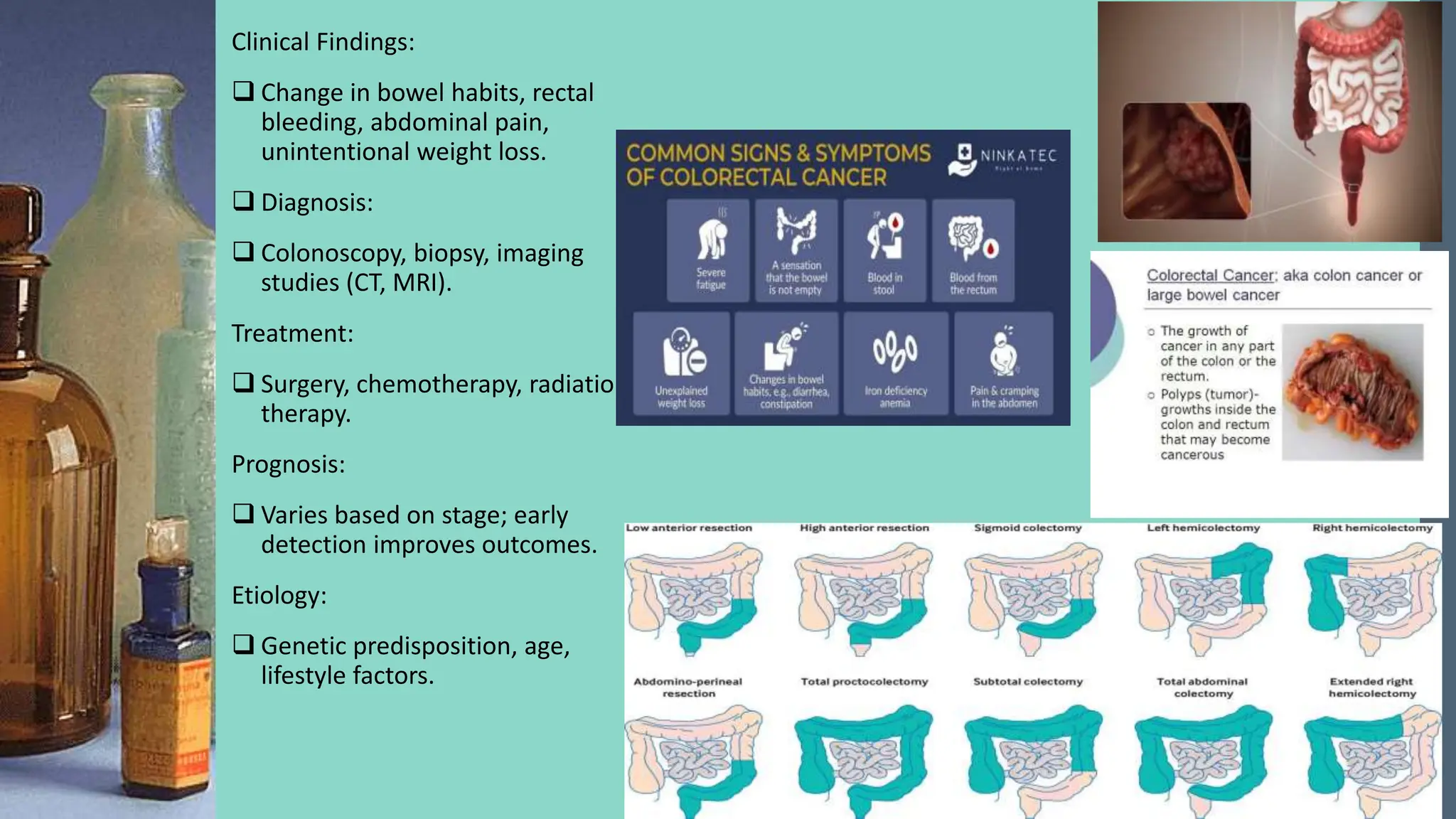 Gastrointestinal Disorders. Ischemic colitis, colon polyps, colorectal ...
