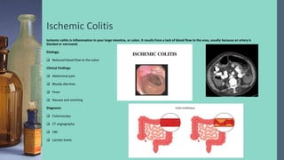 Gastrointestinal Disorders. Ischemic colitis, colon polyps, colorectal ...