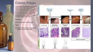 Gastrointestinal Disorders. Ischemic colitis, colon polyps, colorectal ...