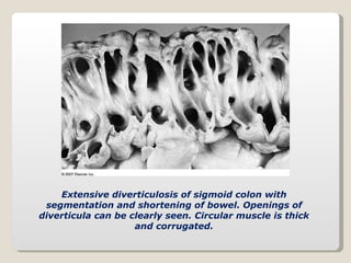 Gastrointestinal disorders 2 | PPT