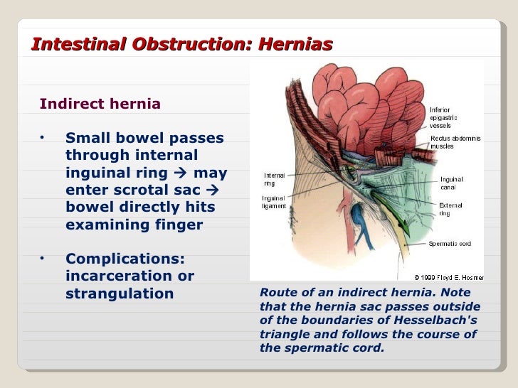 Gastrointestinal disorders 2