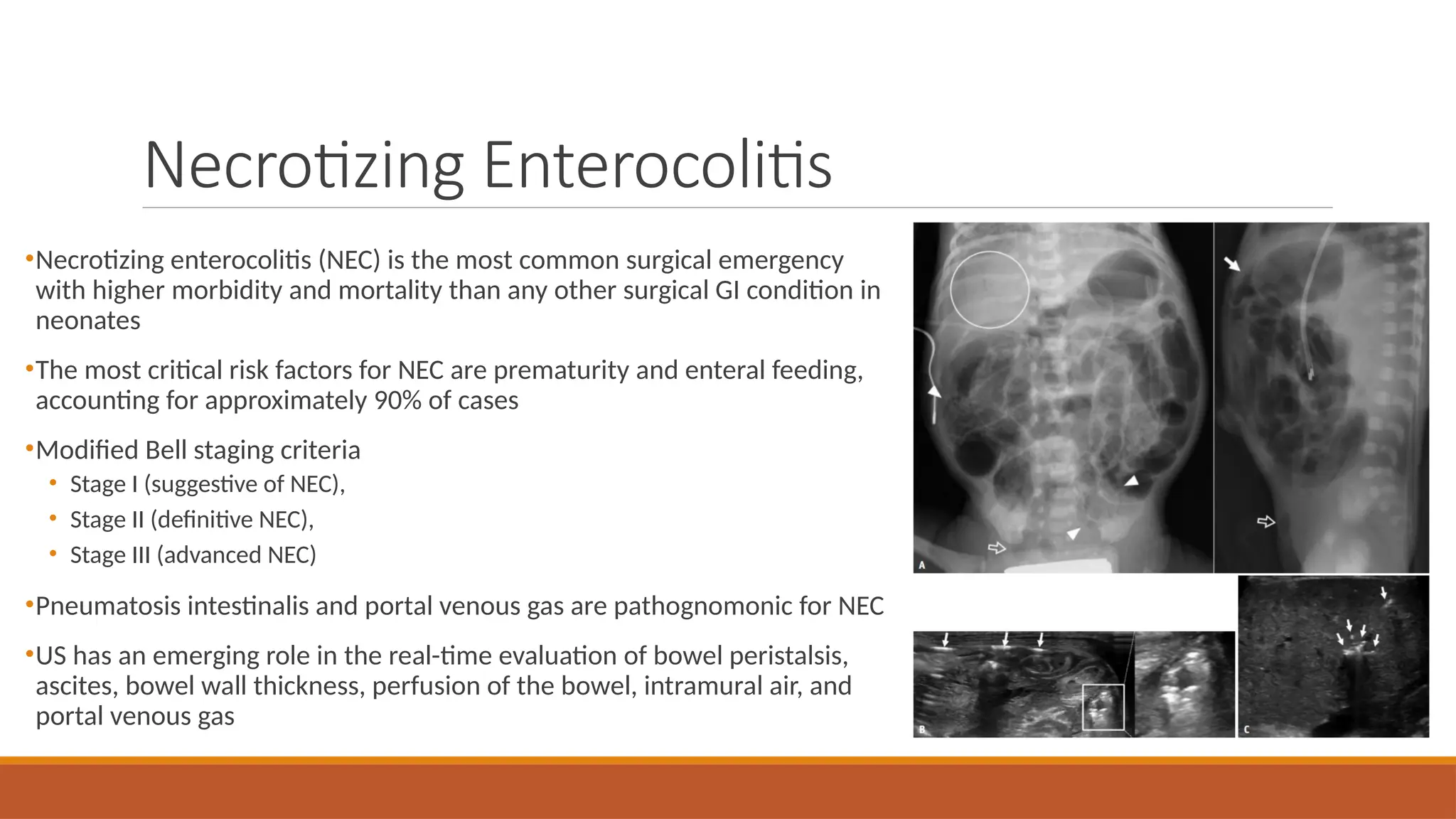 Gastrointestinal Emergency in Neonates and Infants.pptx