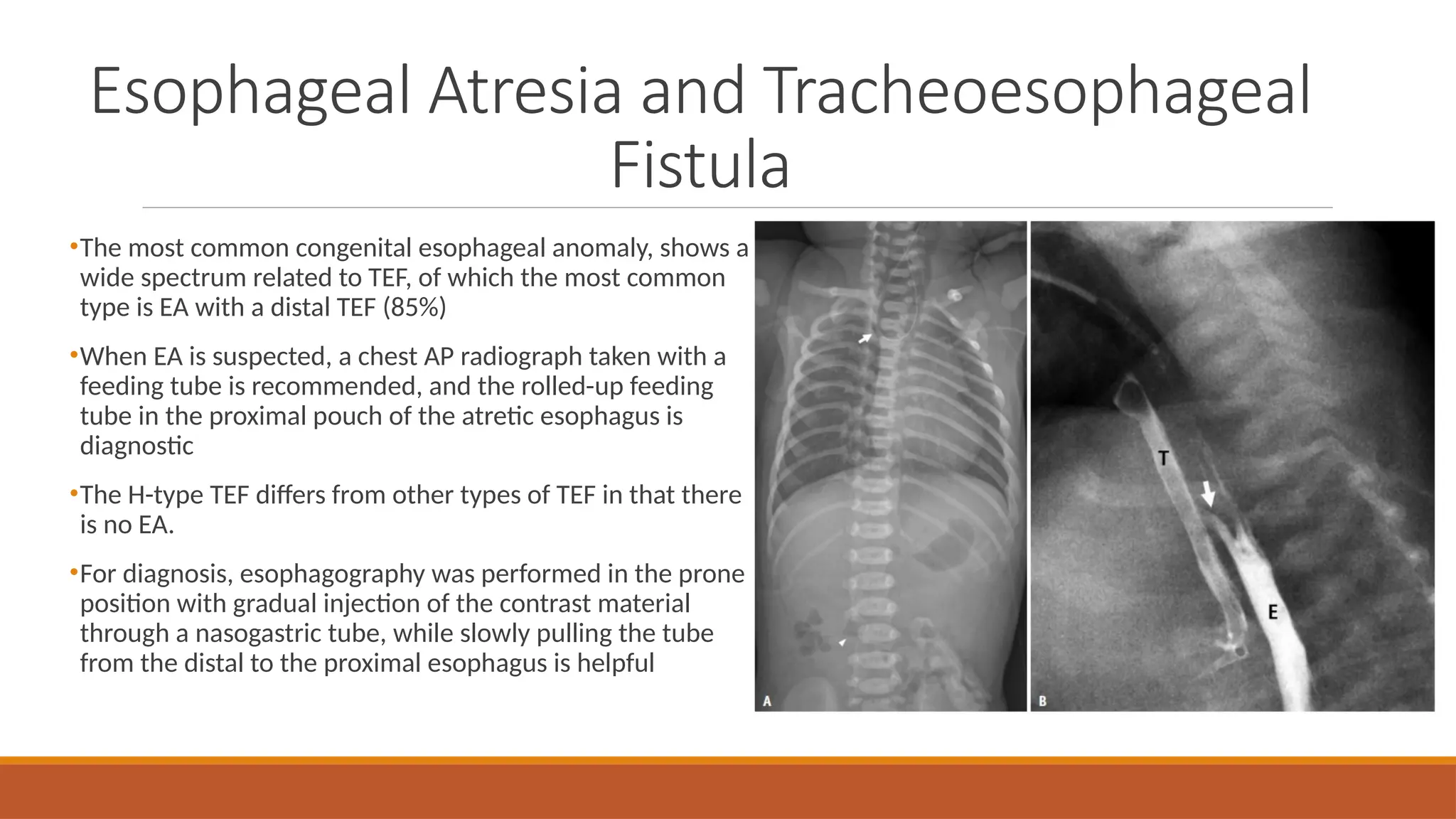 Gastrointestinal Emergency in Neonates and Infants.pptx