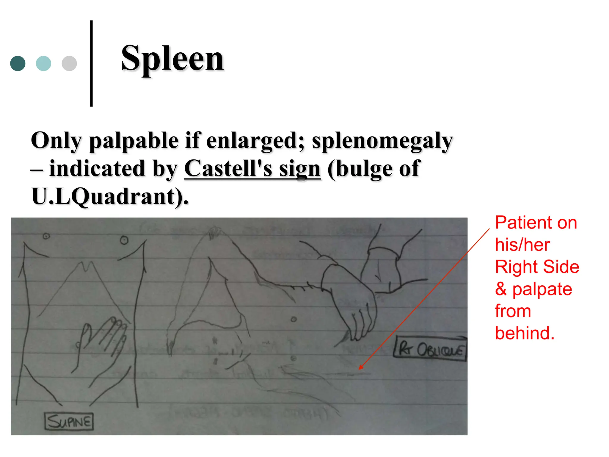 Gastrointestinal (GI) examination. Seminar ppt. | PPT