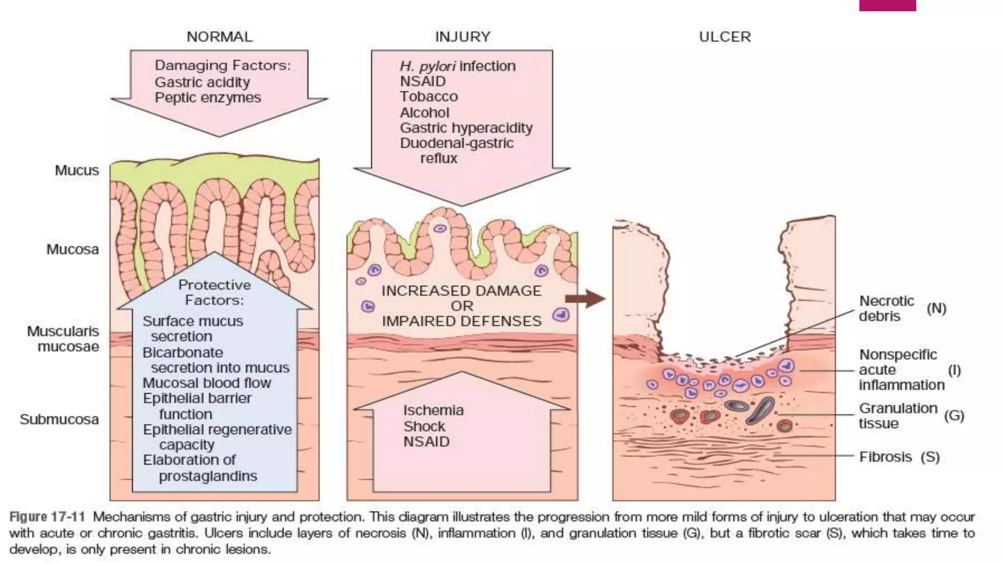 Gastrointestinal & Hepatobiliary System | PPTX