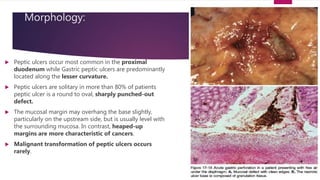 Gastrointestinal & Hepatobiliary System | PPTX