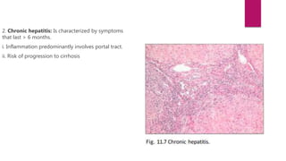 Gastrointestinal & Hepatobiliary System | PPTX