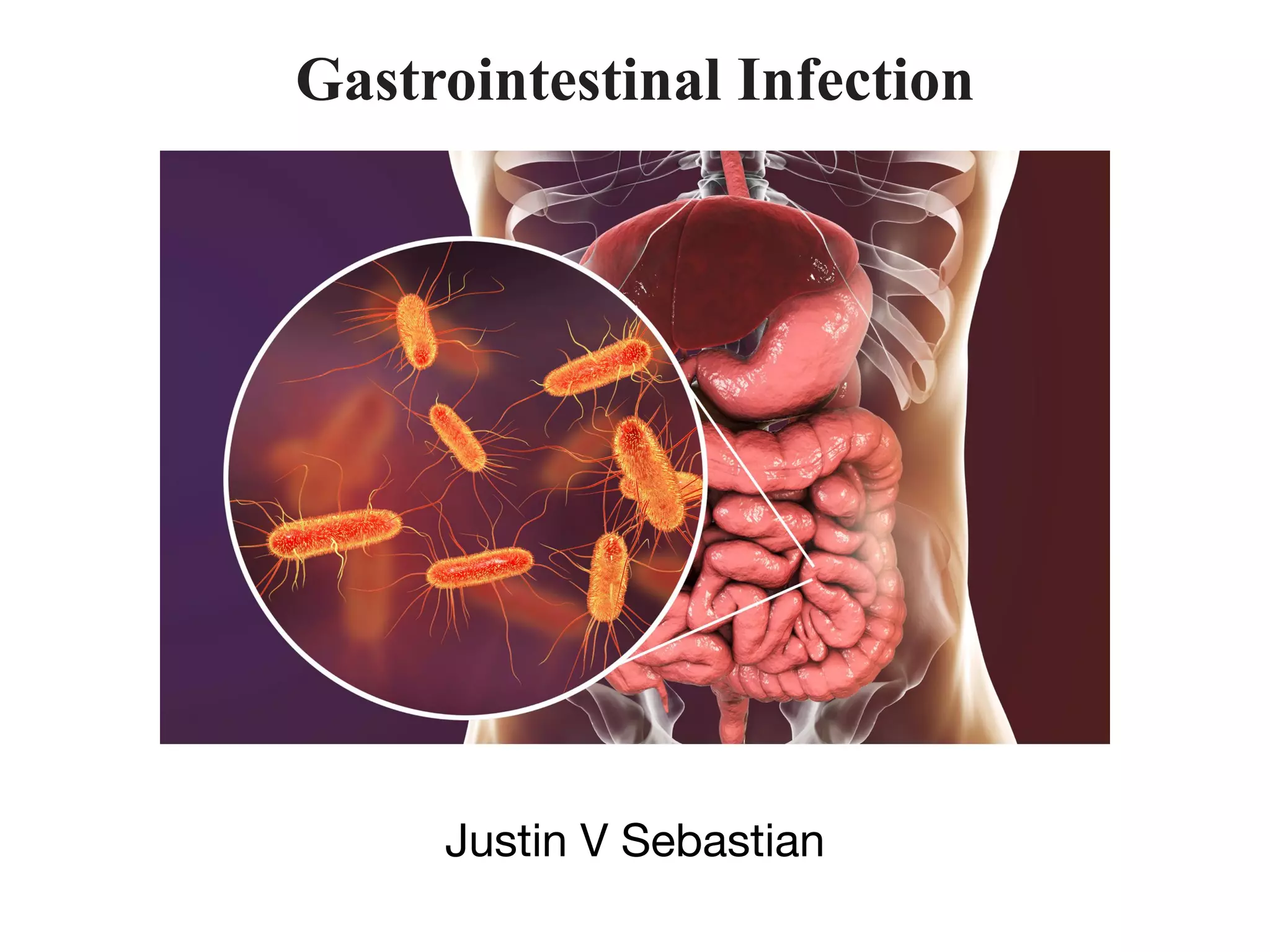 Gastrointestinal Infection.pdf