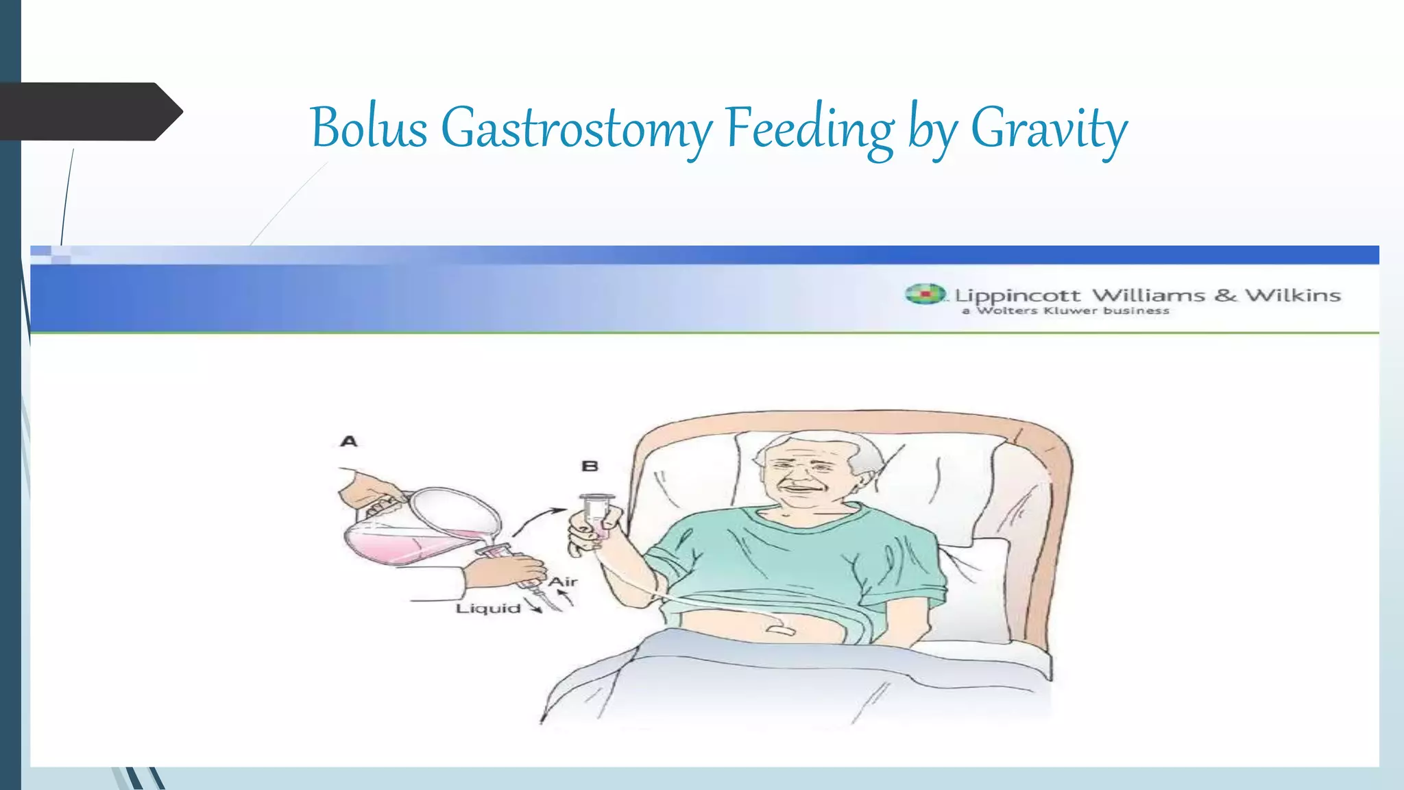 Gastrointestinal intubation.pptx