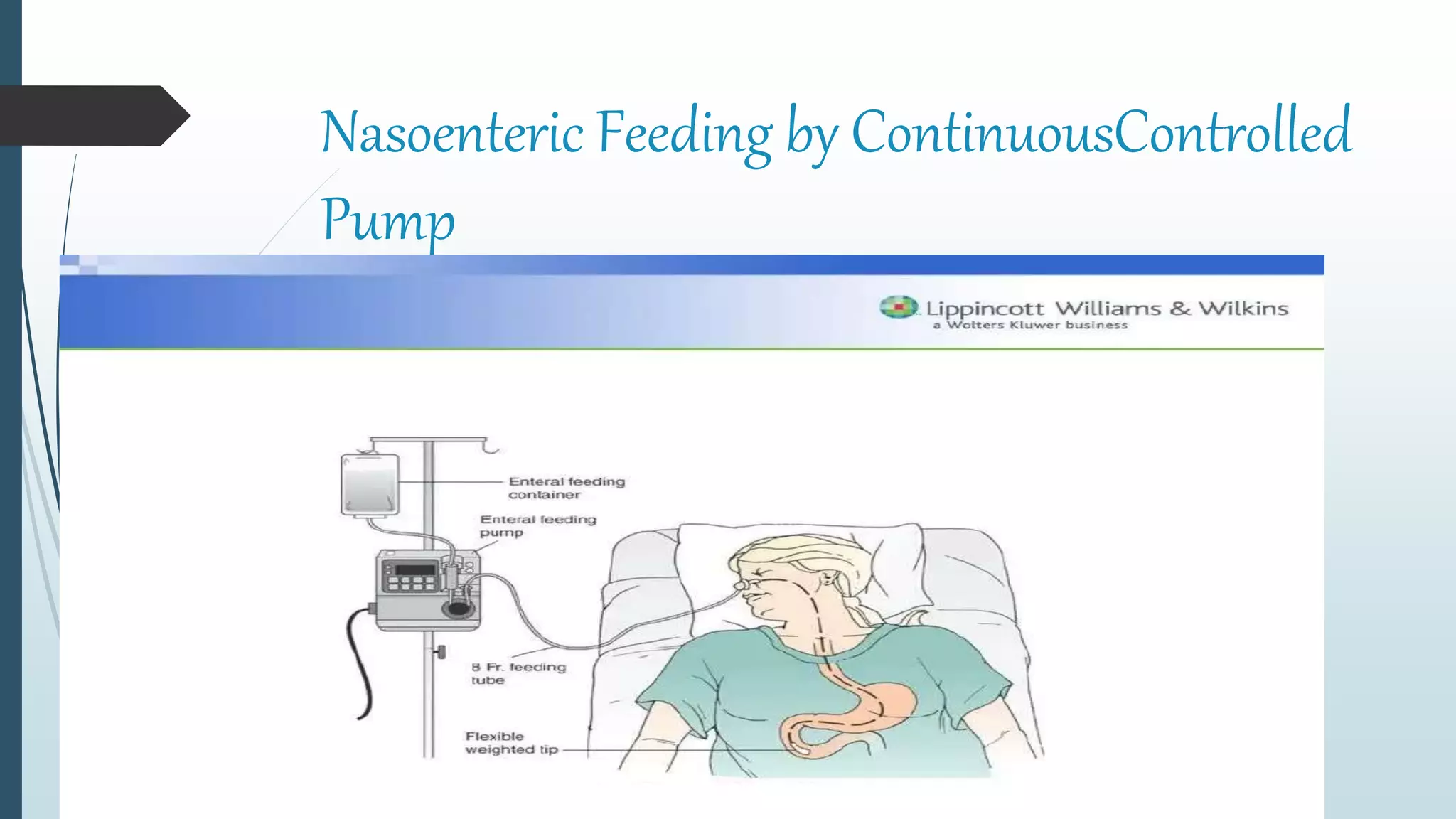 Gastrointestinal intubation.pptx