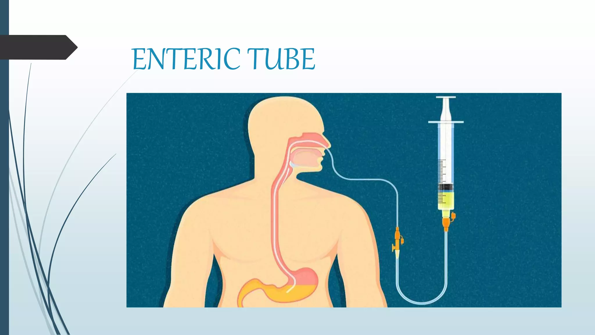 Gastrointestinal intubation.pptx