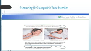 Gastrointestinal intubation.pptx
