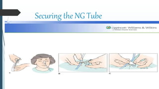 Gastrointestinal intubation.pptx