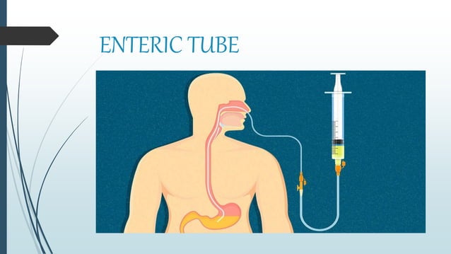 Gastrointestinal intubation.pptx | Digestive Disorders | Diseases and ...